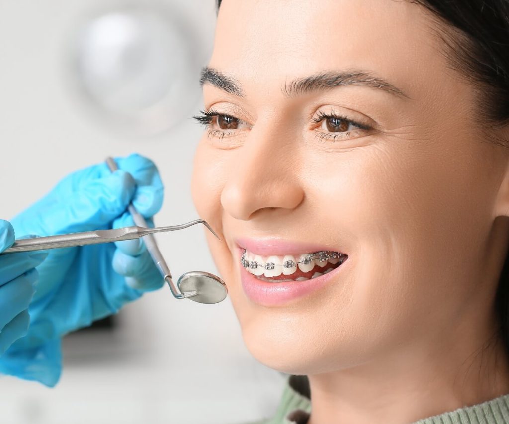 Ortodoncia Tradicional - Maxia Odontología Integral